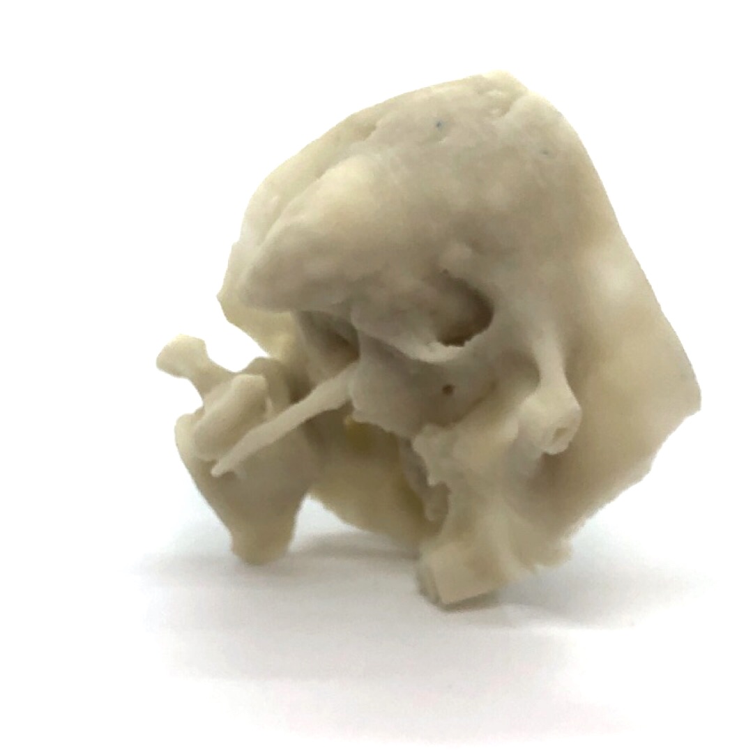 3D Printed Temporal Bone Model | C11 | KEZLEX