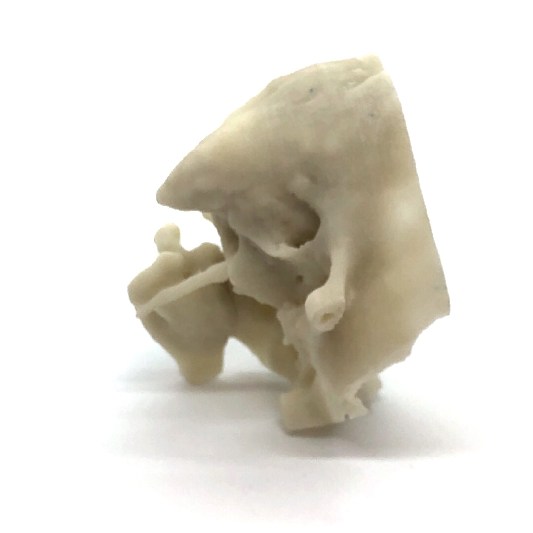 3D Printed Temporal Bone Model | C11 | KEZLEX