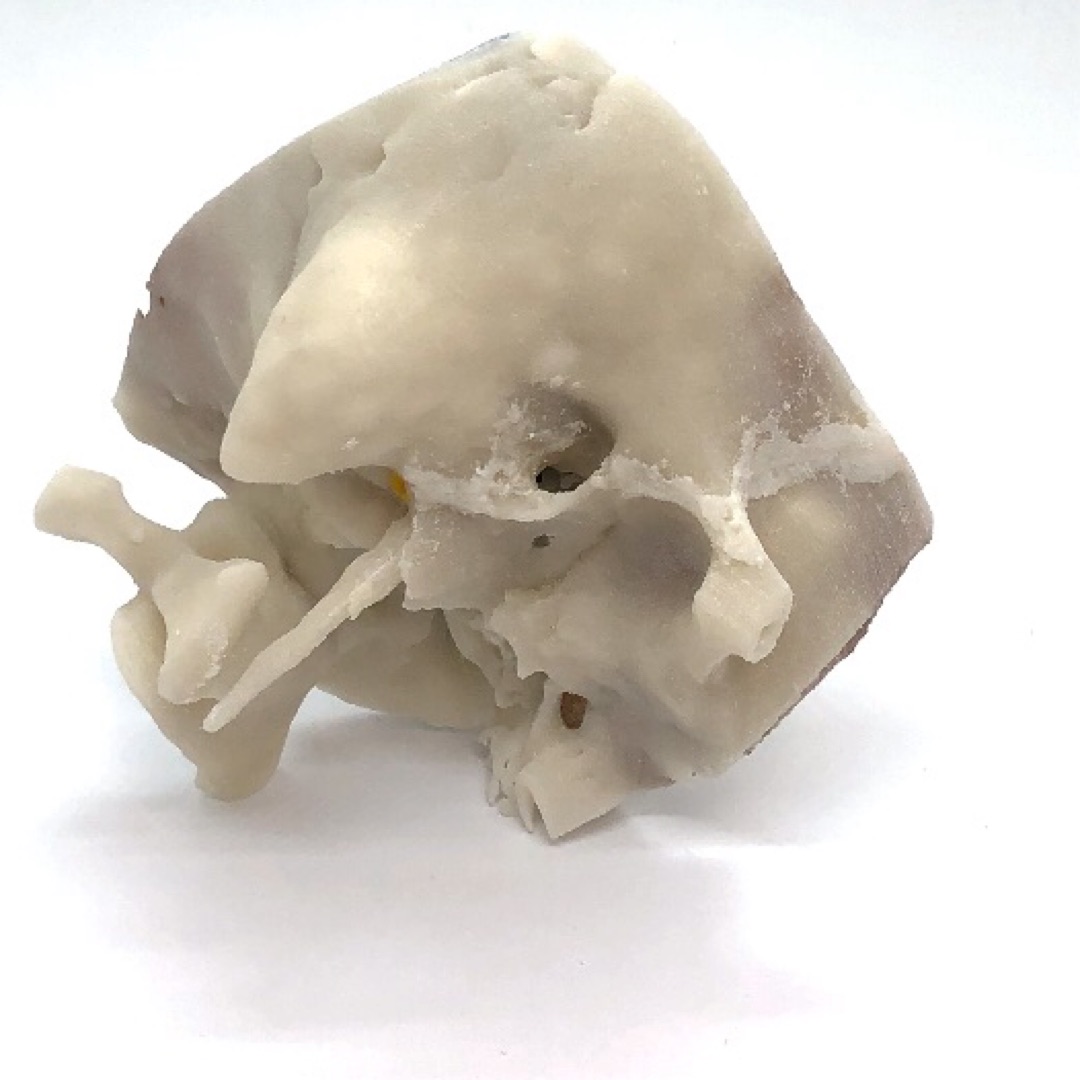 3D Printed Temporal Bone Model Inner Structure Colored Model | C14 | KEZLEX