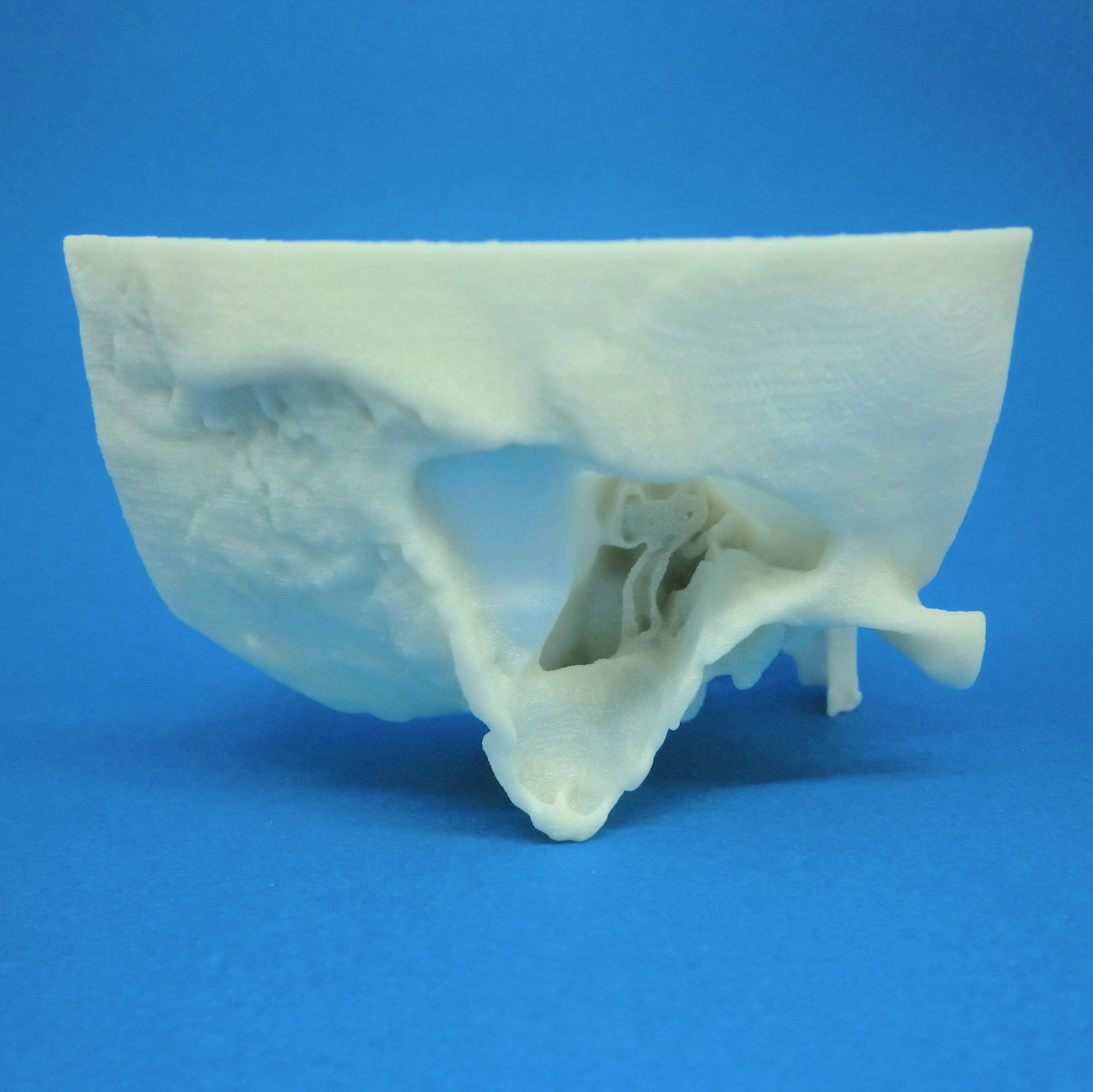 3D Printed Temporal Bone Models | KEZLEX