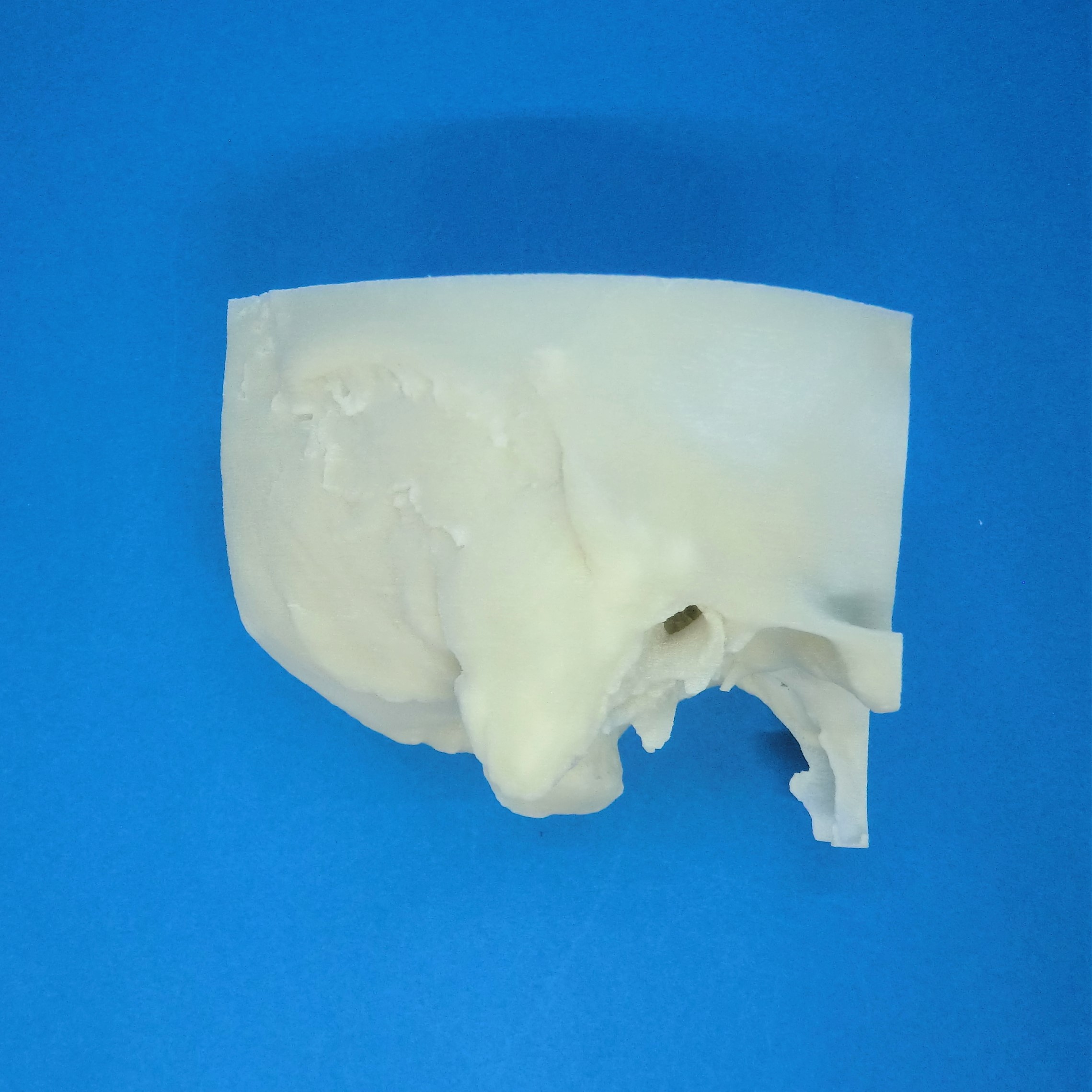 3D Printed Temporal Bone Models | KEZLEX