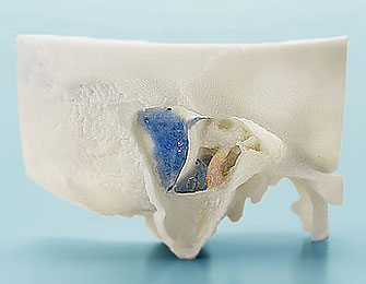3D Printed Temporal Bone Models | KEZLEX