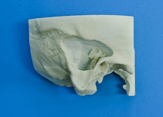 3D Printed Temporal Bone Models | KEZLEX